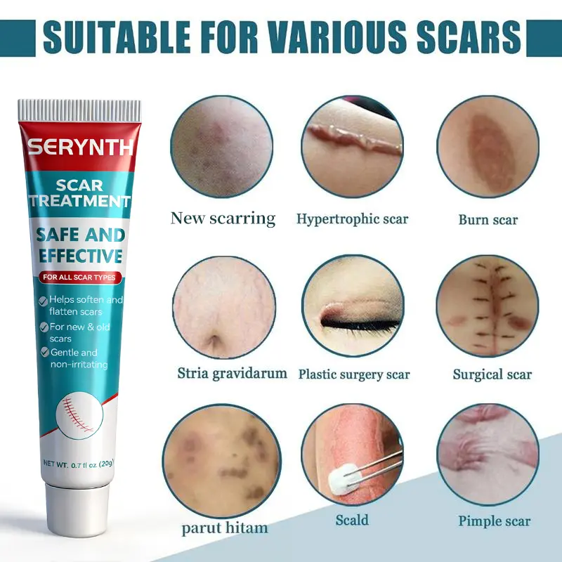 Black scab scar remover, leg scar remover, chicken pox scar remover ...